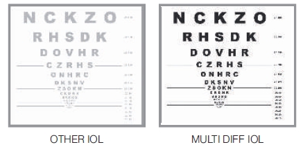 Multi Diff - Appasamy Hydrophilic Acrylic Lens/ Surgical IOL