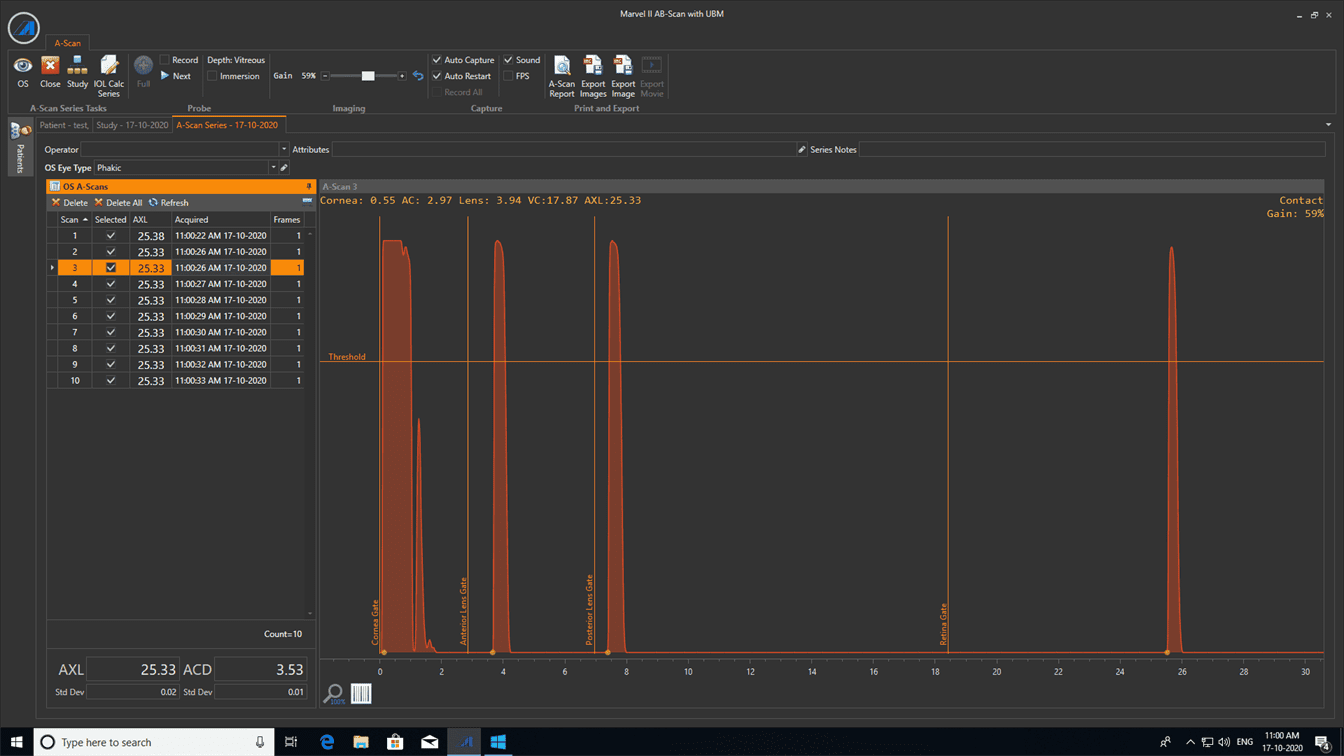 AB-SCAN with UBM: Ophthalmic Ultrasound Scanner - Appasamy