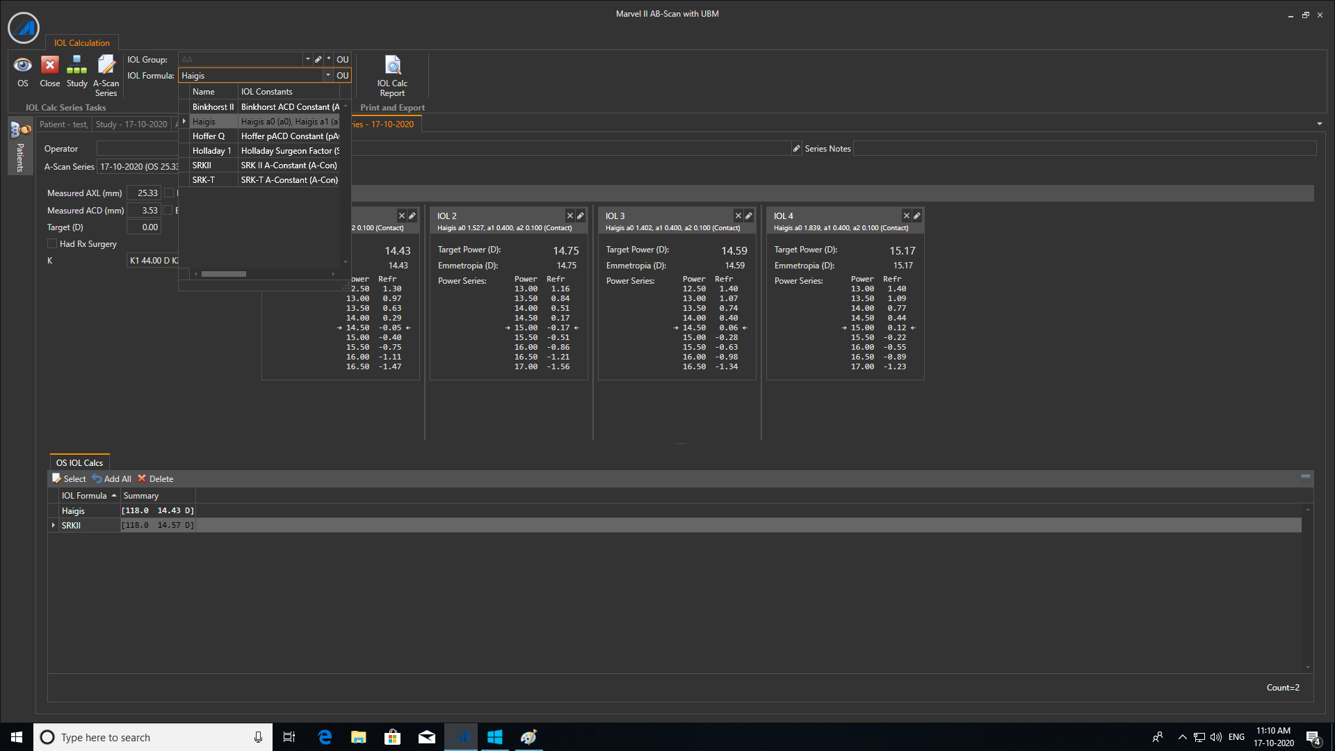 AB-SCAN with UBM: Ophthalmic Ultrasound Scanner - Appasamy