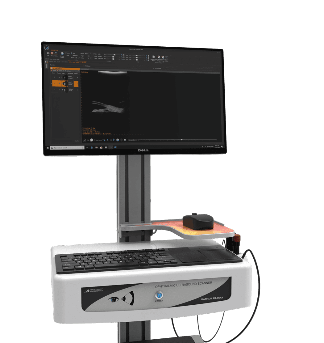 AB-SCAN with UBM: Ophthalmic Ultrasound Scanner - Appasamy