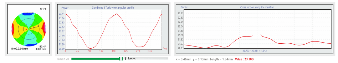 Supra Phob Toric - Appasamy Hydrophobic Acrylic Lens/ Surgical IOL