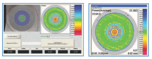 Supra Phob Infocus - Appasamy Hydrophobic Acrylic Lens/ Surgical IOL