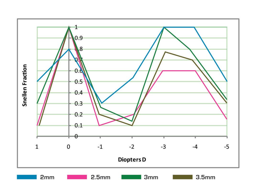 Supra Phob Infocus - Appasamy Hydrophobic Acrylic Lens/ Surgical IOL