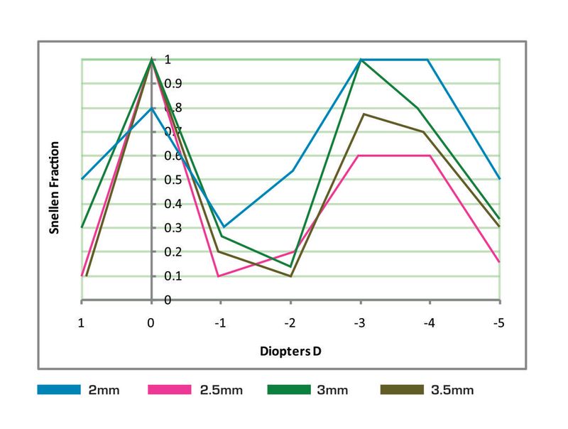 Supra Phob Infocus - Appasamy Hydrophobic Acrylic Lens/ Surgical IOL