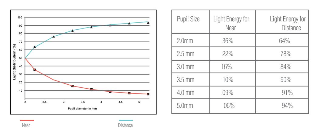 Supra Phob Infocus - Appasamy Hydrophobic Acrylic Lens/ Surgical IOL