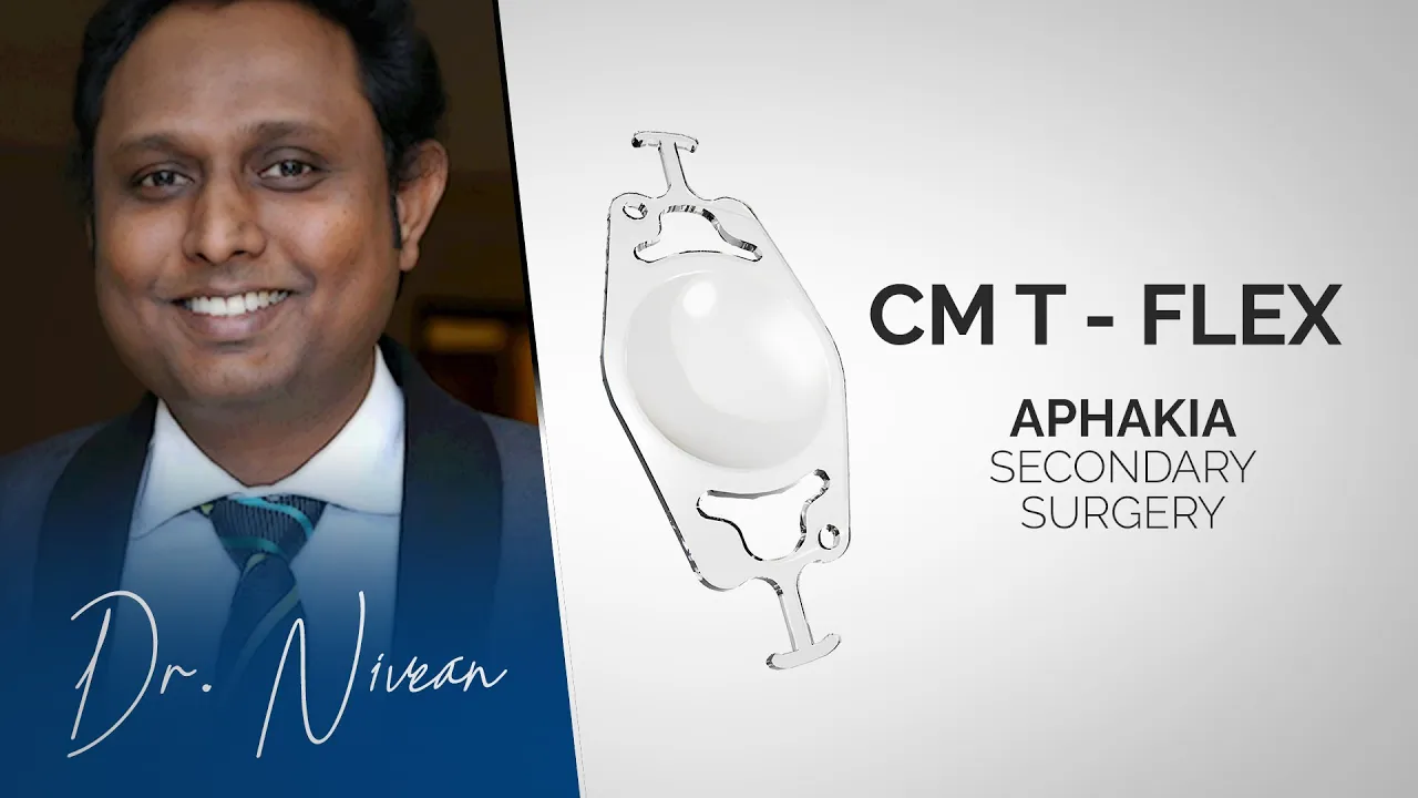 CM-T Flex - Appasamy Hydrophilic Acrylic Lens/ Surgical IOL