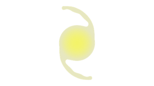 Supra Phob BBY - Appasamy Hydrophobic Acrylic Lens/ Surgical IOL