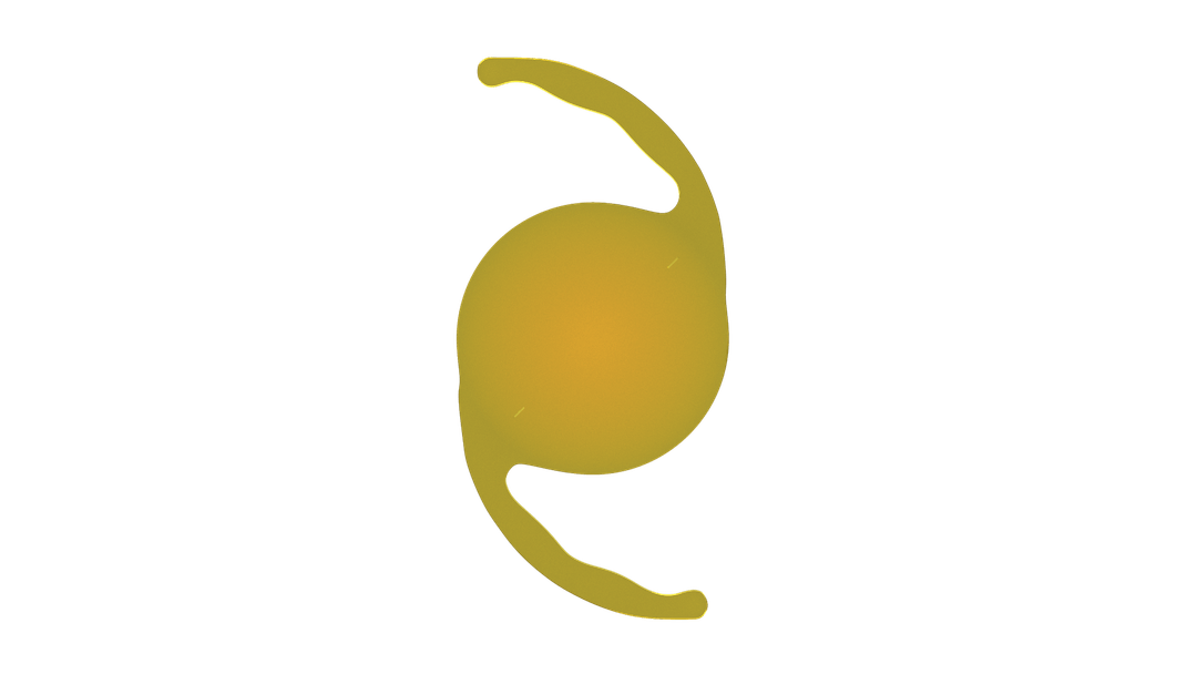 Supra Phob Toric - Appasamy Hydrophobic Acrylic Lens/ Surgical IOL