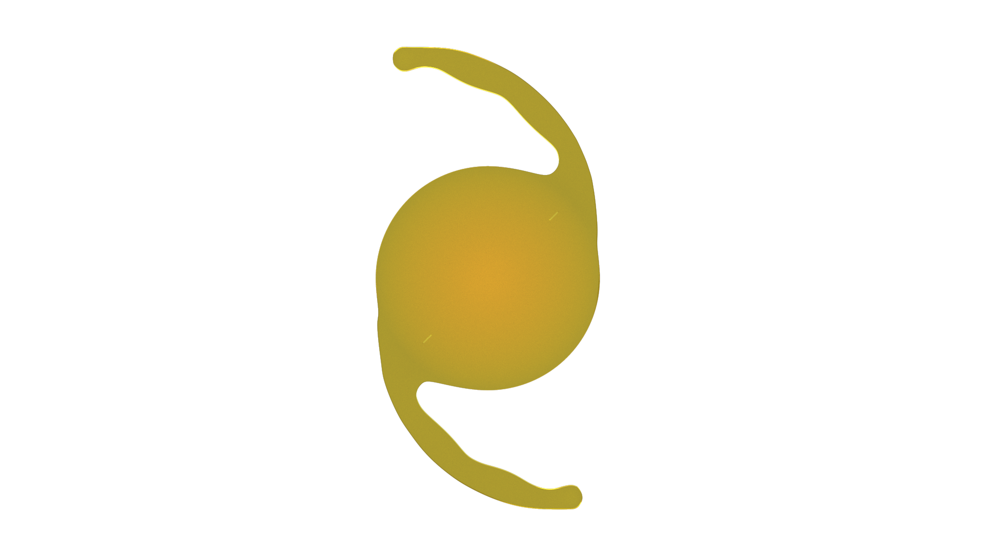 Supra Phob Toric - Appasamy Hydrophobic Acrylic Lens/ Surgical IOL