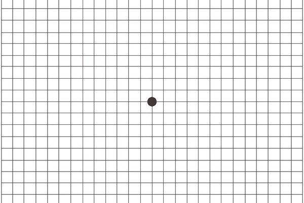 Il test di Amsler - STAR 9000 | Brescia