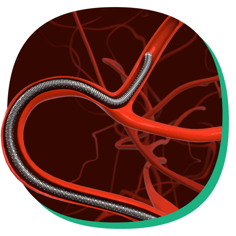 Aristotle Colossus | Scientia Vascular