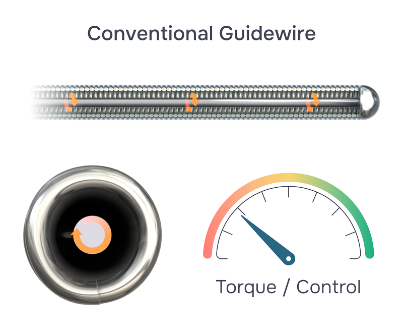 Scientia Vascular - Leading Access to Therapy