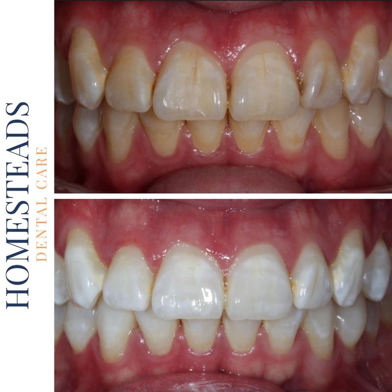 Essex Dental Practice - Homesteads Dental Care