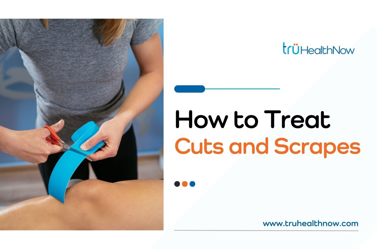 How to Treat Cuts and Scrapes | trüHealthNow