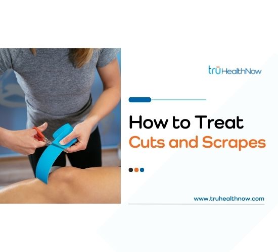 How to Treat Cuts and Scrapes | trüHealthNow