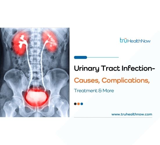 Understanding Urinary Tract Infections: Causes, Treatment & More