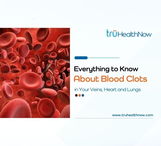Everything to Know About Blood Clots in Your Veins, Heart and Lungs ...