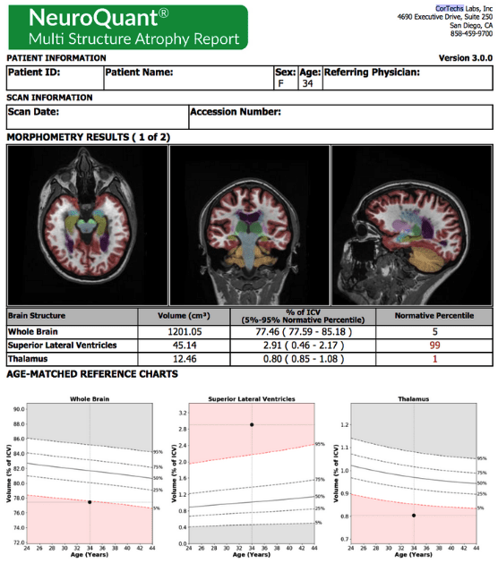 Got Mold? Let's Find Out
