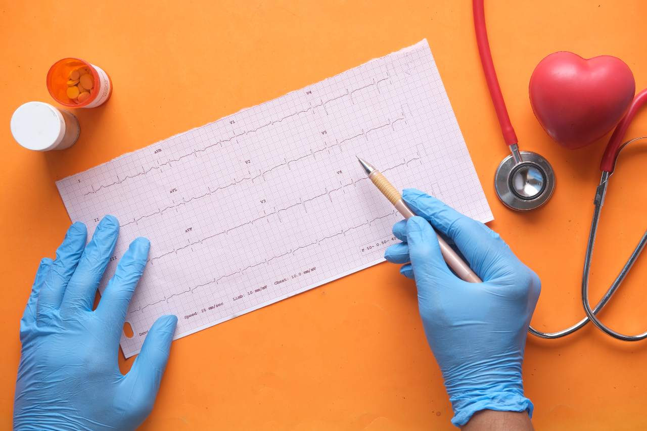 HCA | Cardiac Rhythm Test | Nursa Credentials | Importance of HCA ...