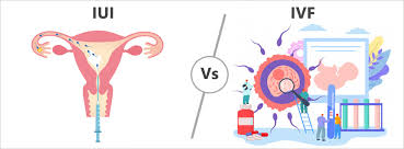 IVF vs IUI: Understanding Effectiveness, Advantages, and Cost