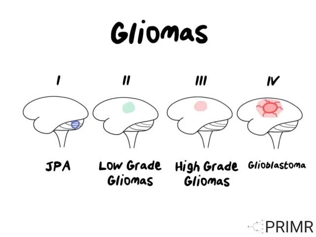 PRIMR | Glioma Brain Tumor