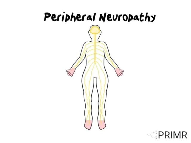 PRIMR | Chemotherapy-Induced Peripheral Neuropathy