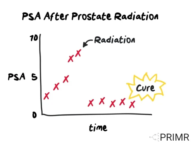 PRIMR | PSA After Radiation for Prostate Cancer