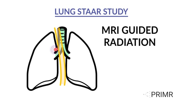 PRIMR | Lung Cancer Clinical Trial | LUNG STAAR Trial