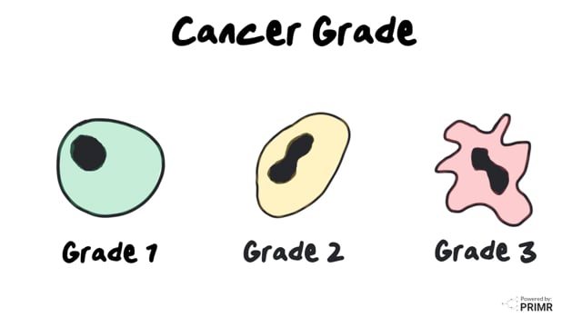 What does cancer grade mean? - PRIMR