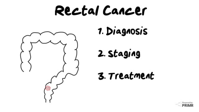 PRIMR | New Rectal Cancer Diagnosis - What to Expect