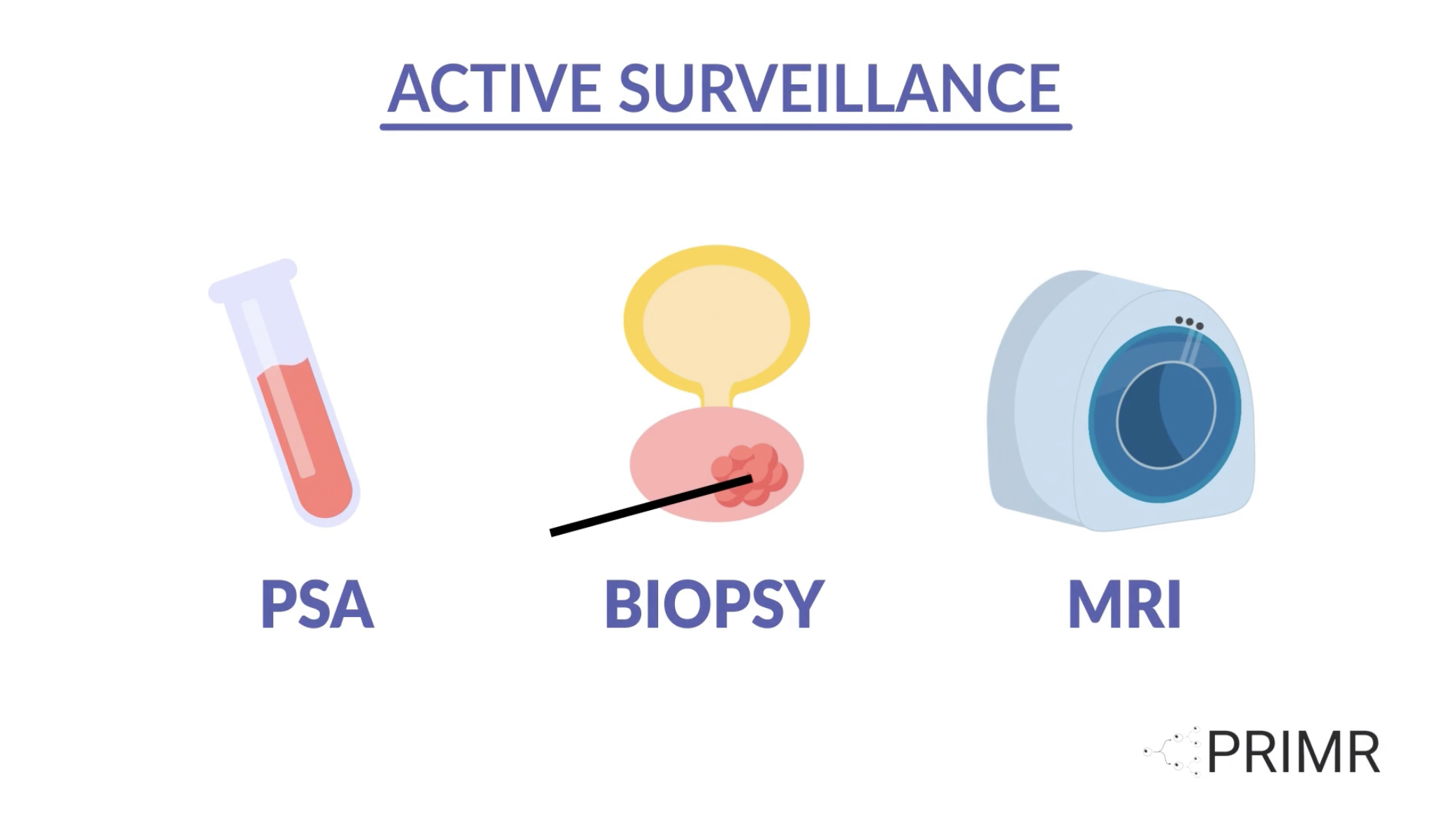 What is Active Surveillance for Prostate Cancer? - PRIMR