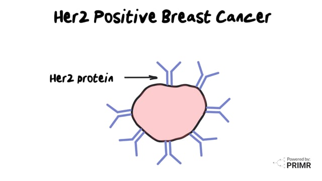 PRIMR | HER2-positive Breast Cancer