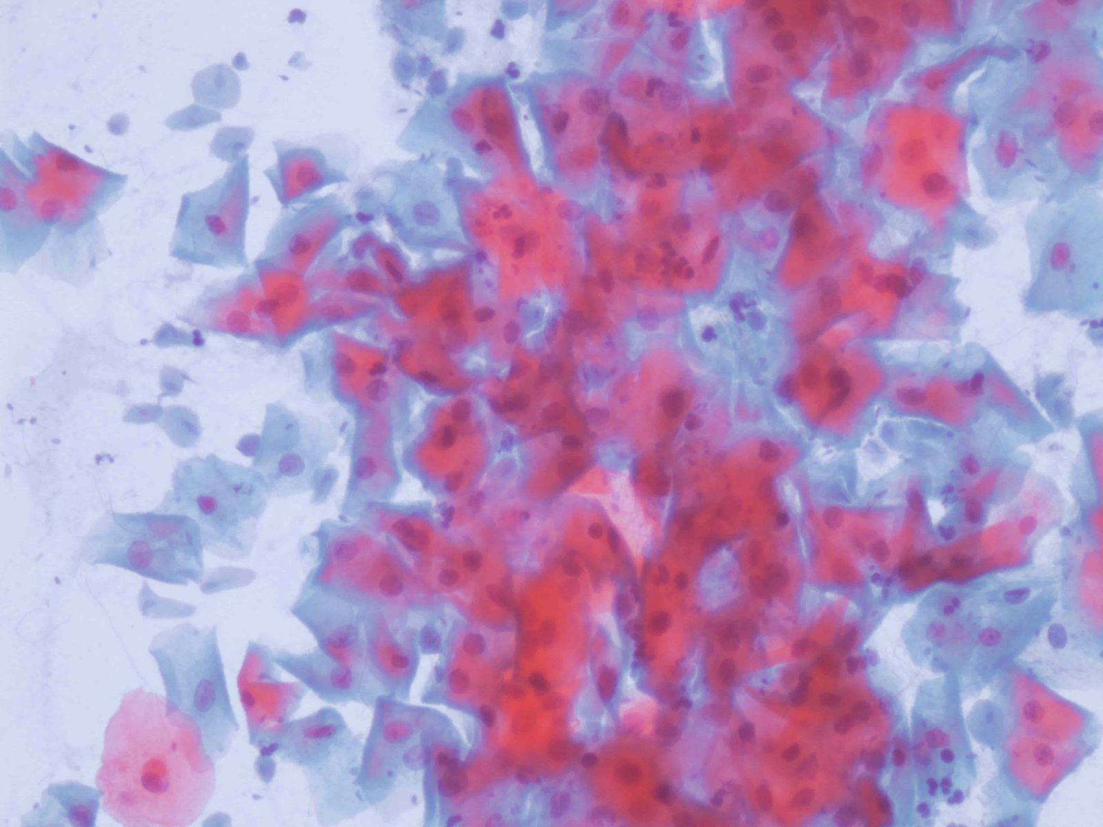 What Is Trichomoniasis? | Evvy