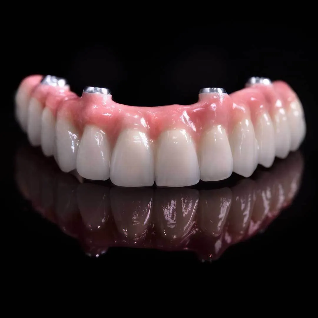 Denture Implants Caldwell & Boise | New Smile Dentures