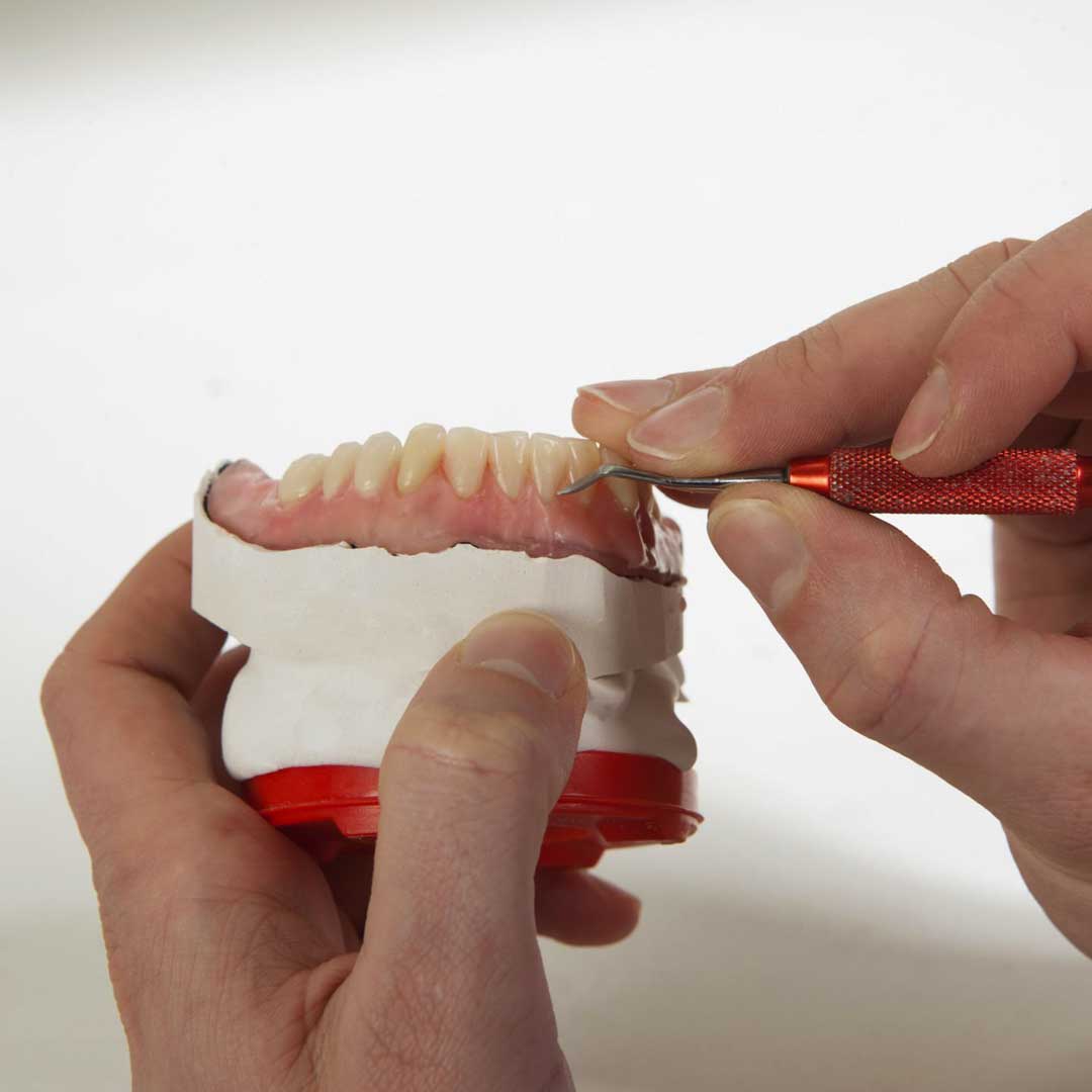 Immediate Dentures | Same-Day Smiles | New Smile Dentures