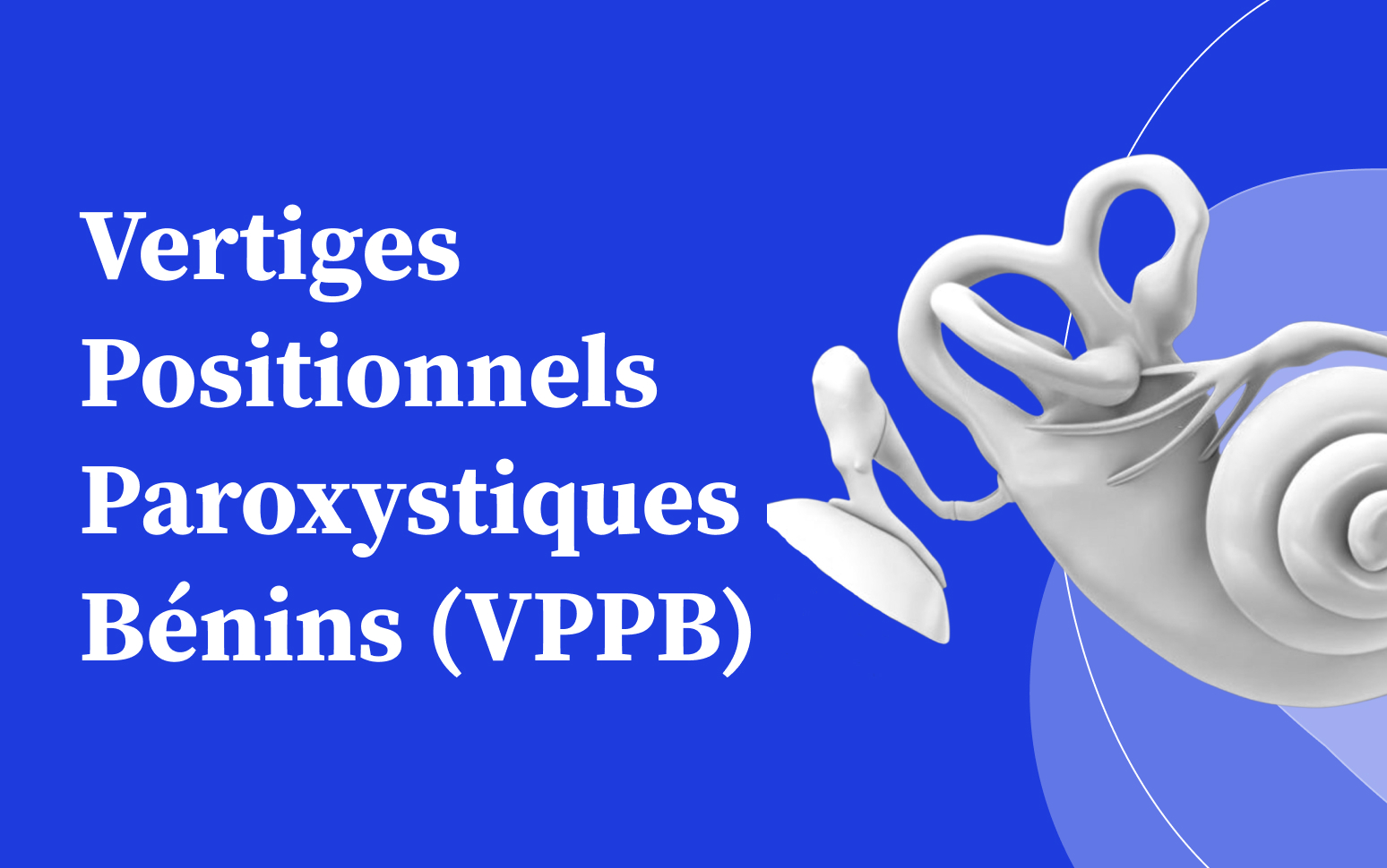 Fiche synthèse - Les vertiges positionnels paroxystiques bénins (VPPB)