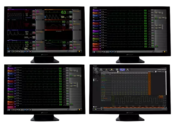 Spacelabs Central Xhibit 96102 - Visualización centralizada de datos