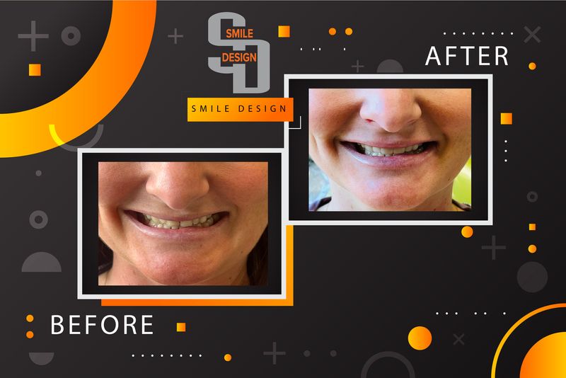 Dentist in Durham, NC | Smile Design - Dr. Erfan Imeni | Home