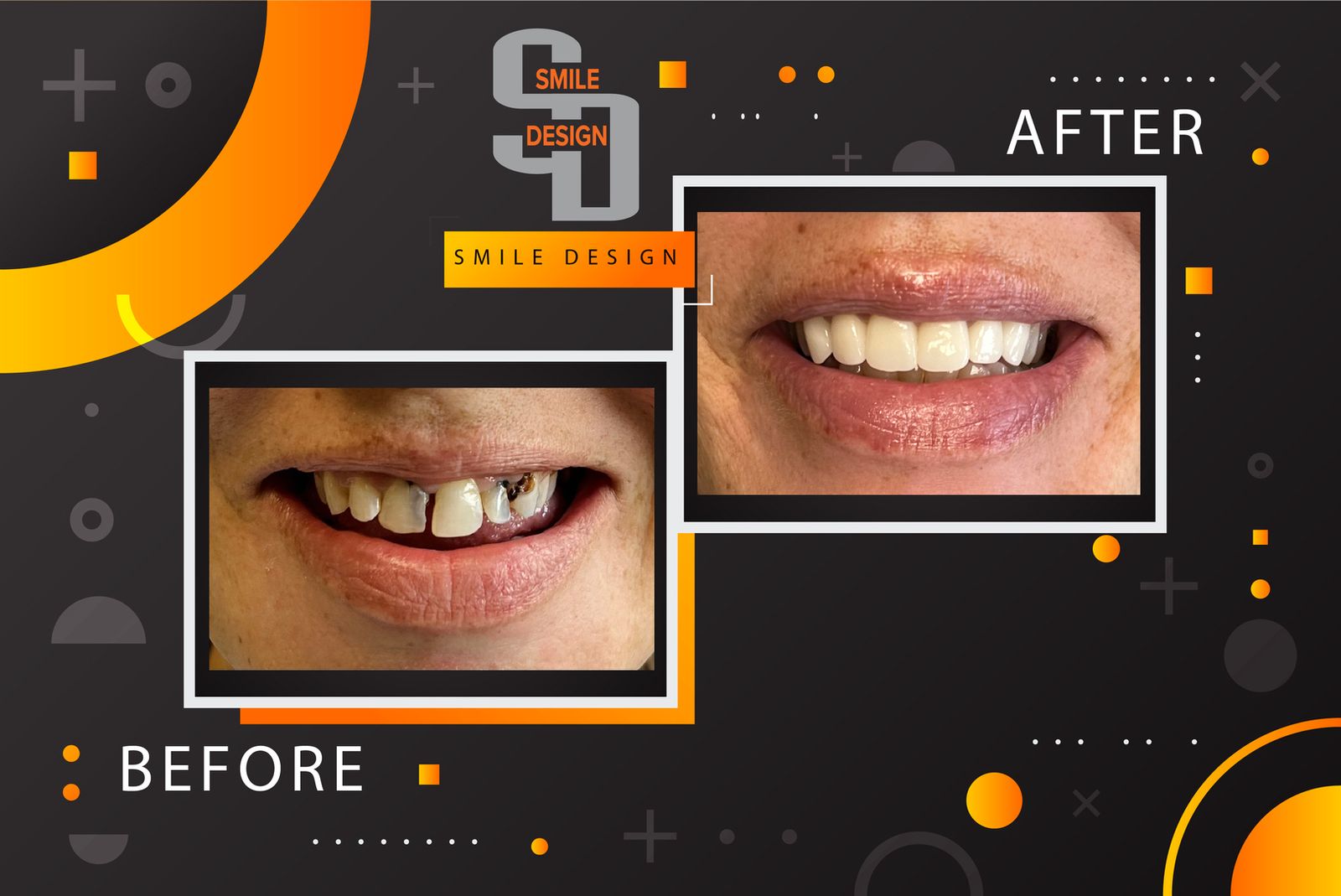 Dentist in Durham, NC | Smile Design - Dr. Erfan Imeni | Home