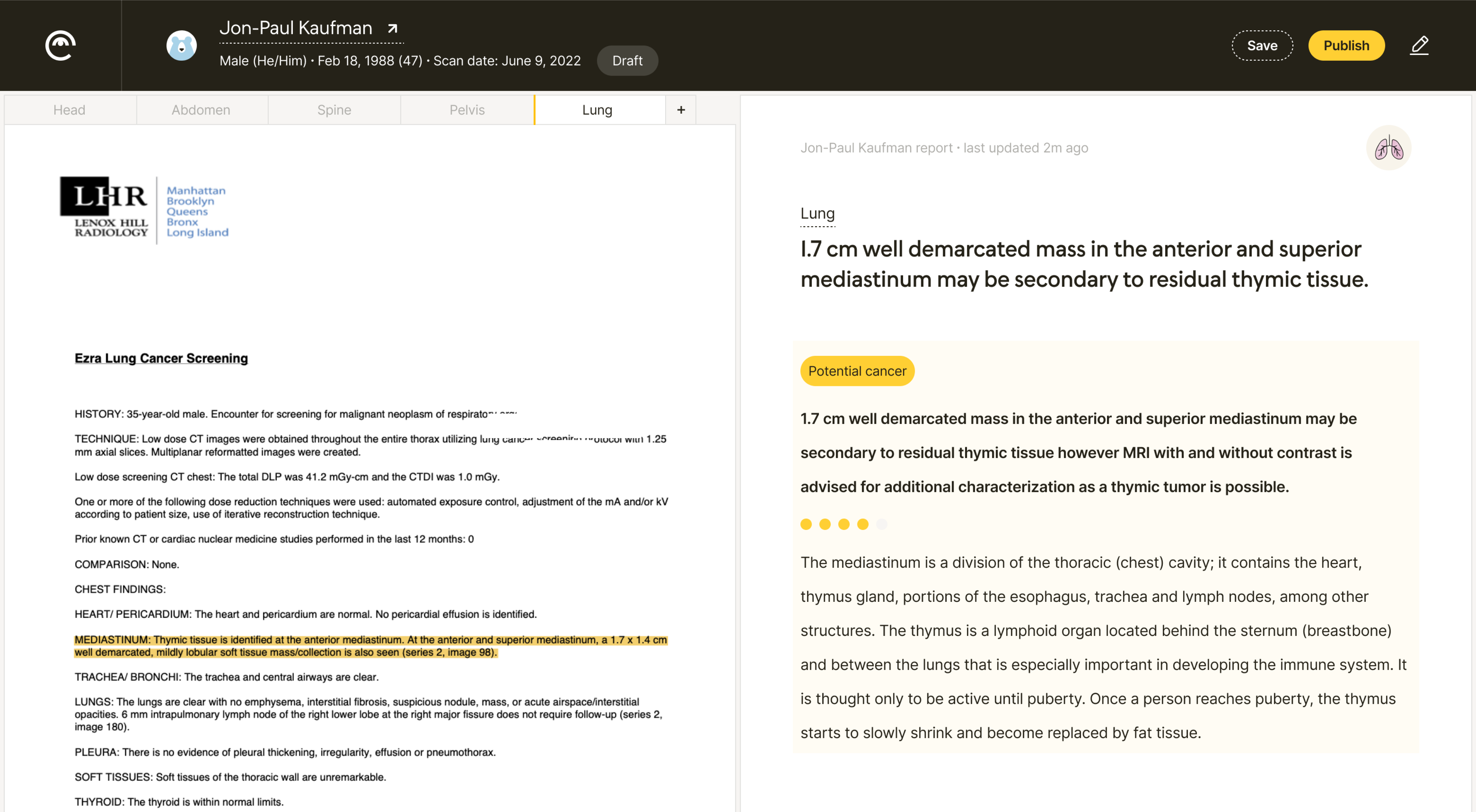 Ezra Announces New AI Solution That Converts Radiology Reports into ...