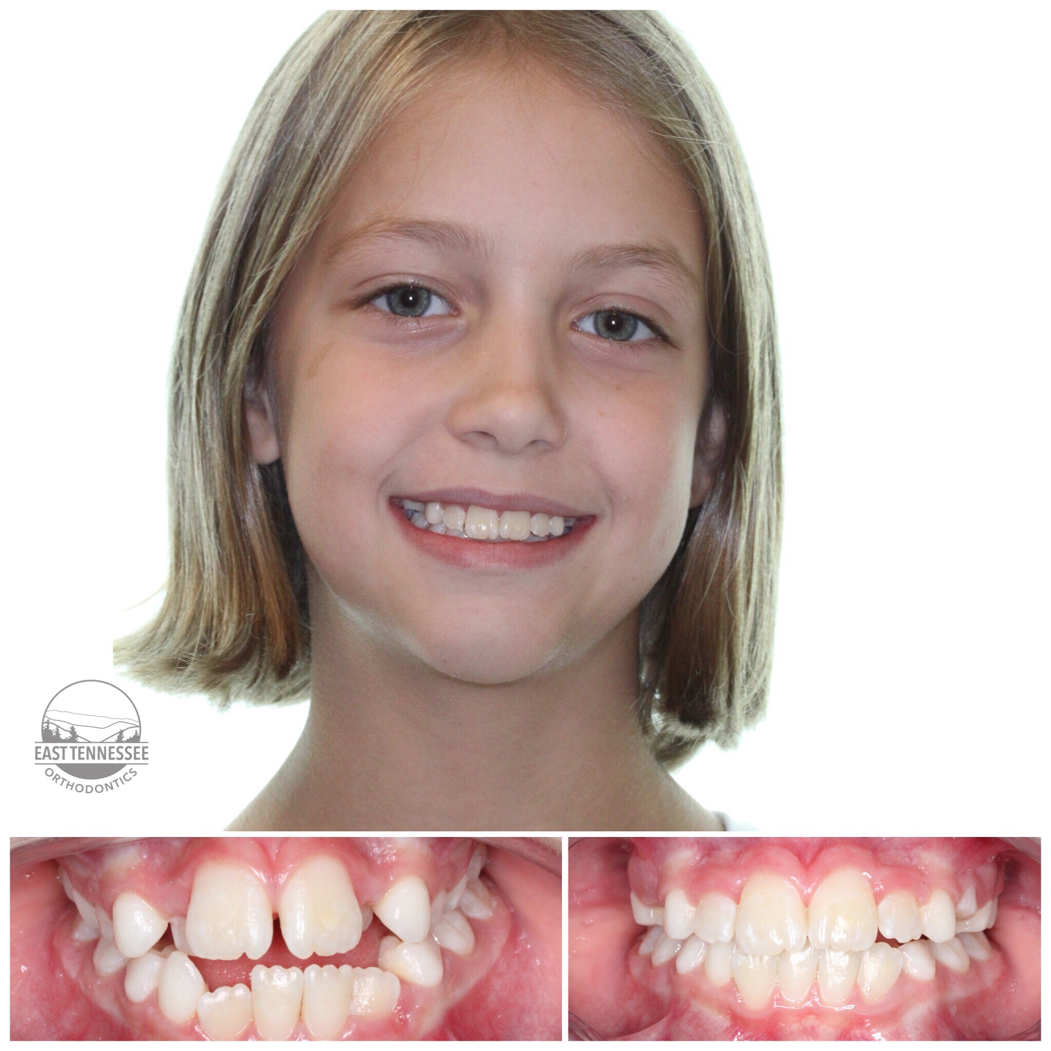 Before & After: Witness the Transformations