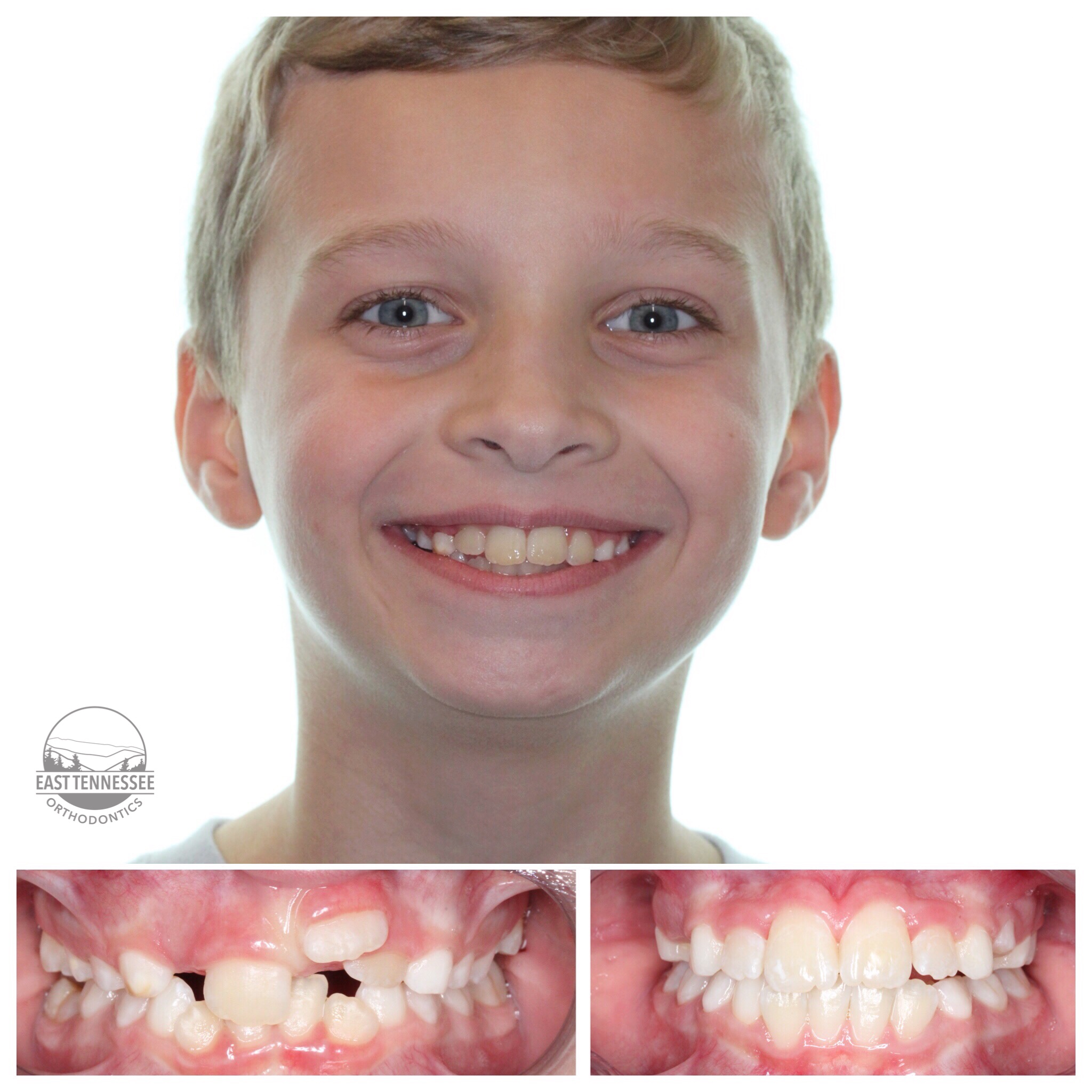 Before & After: Witness the Transformations
