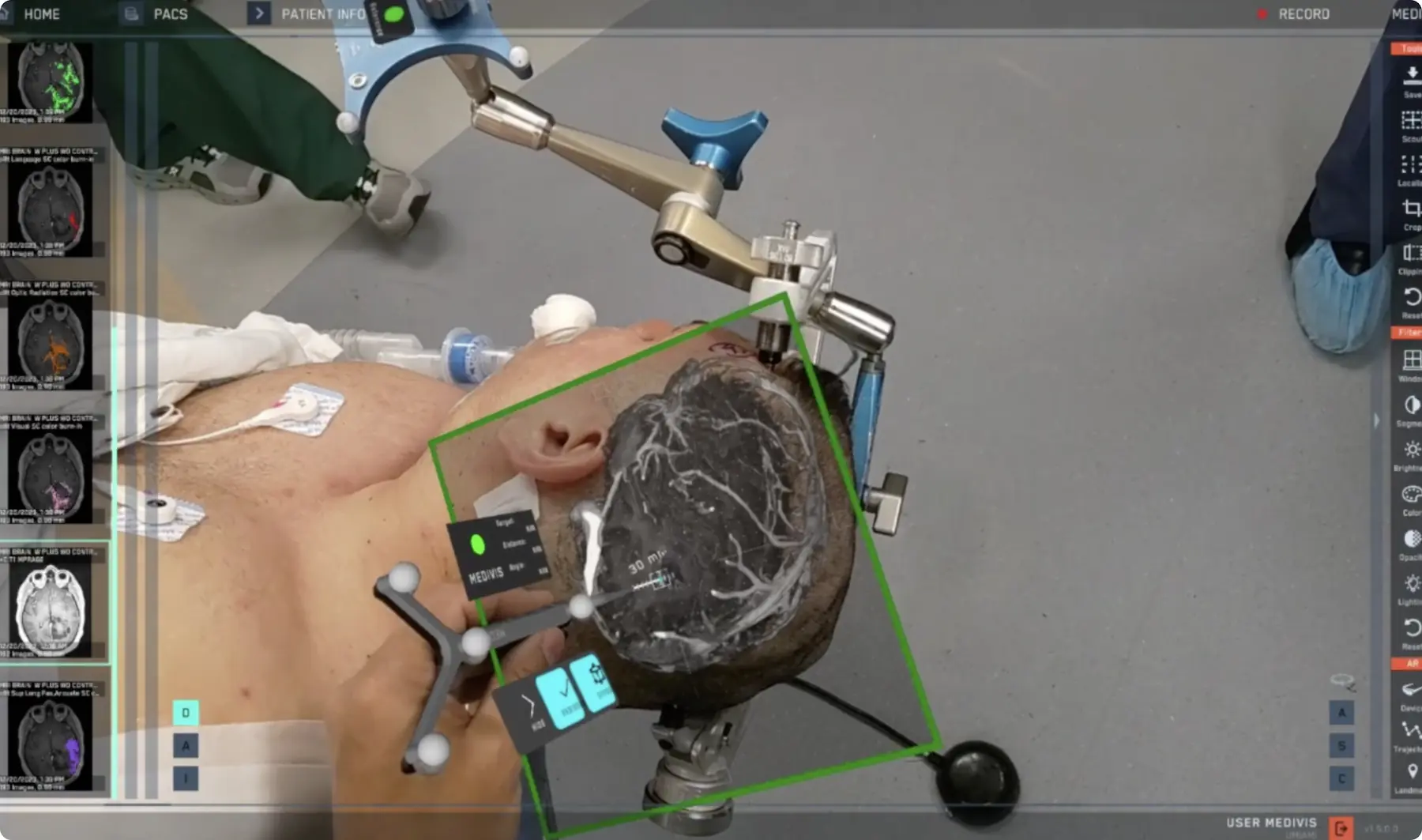 The last surgical imaging platform you'll ever need.