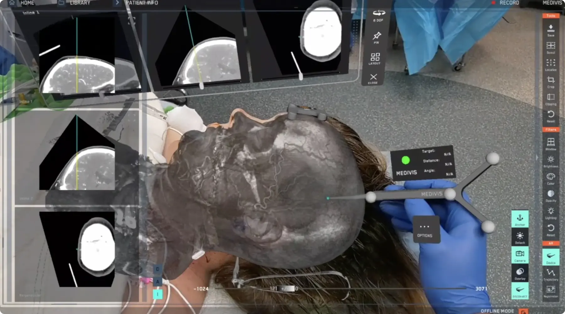 The last surgical imaging platform you'll ever need.