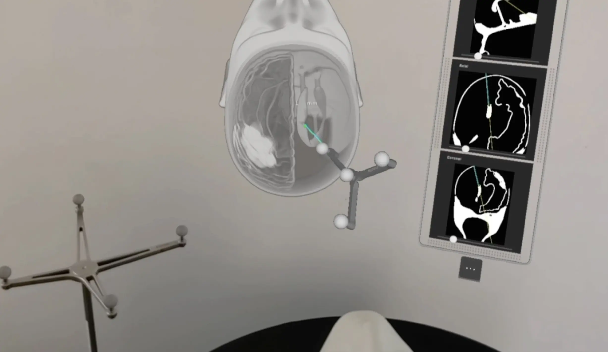 A new standard of surgery using augmented reality.