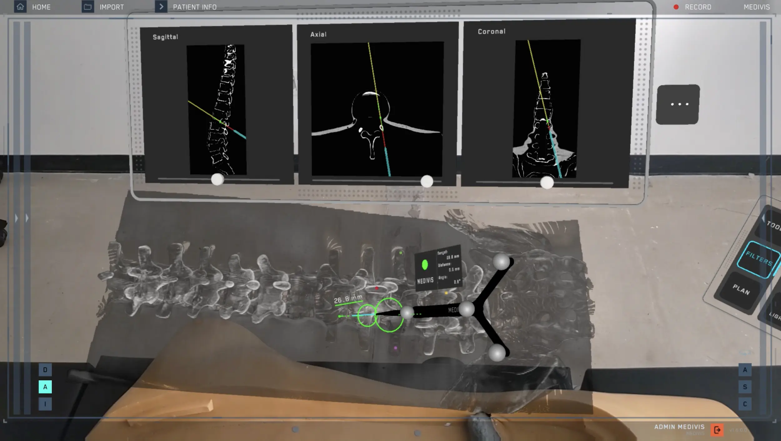 A new standard of surgery using augmented reality.