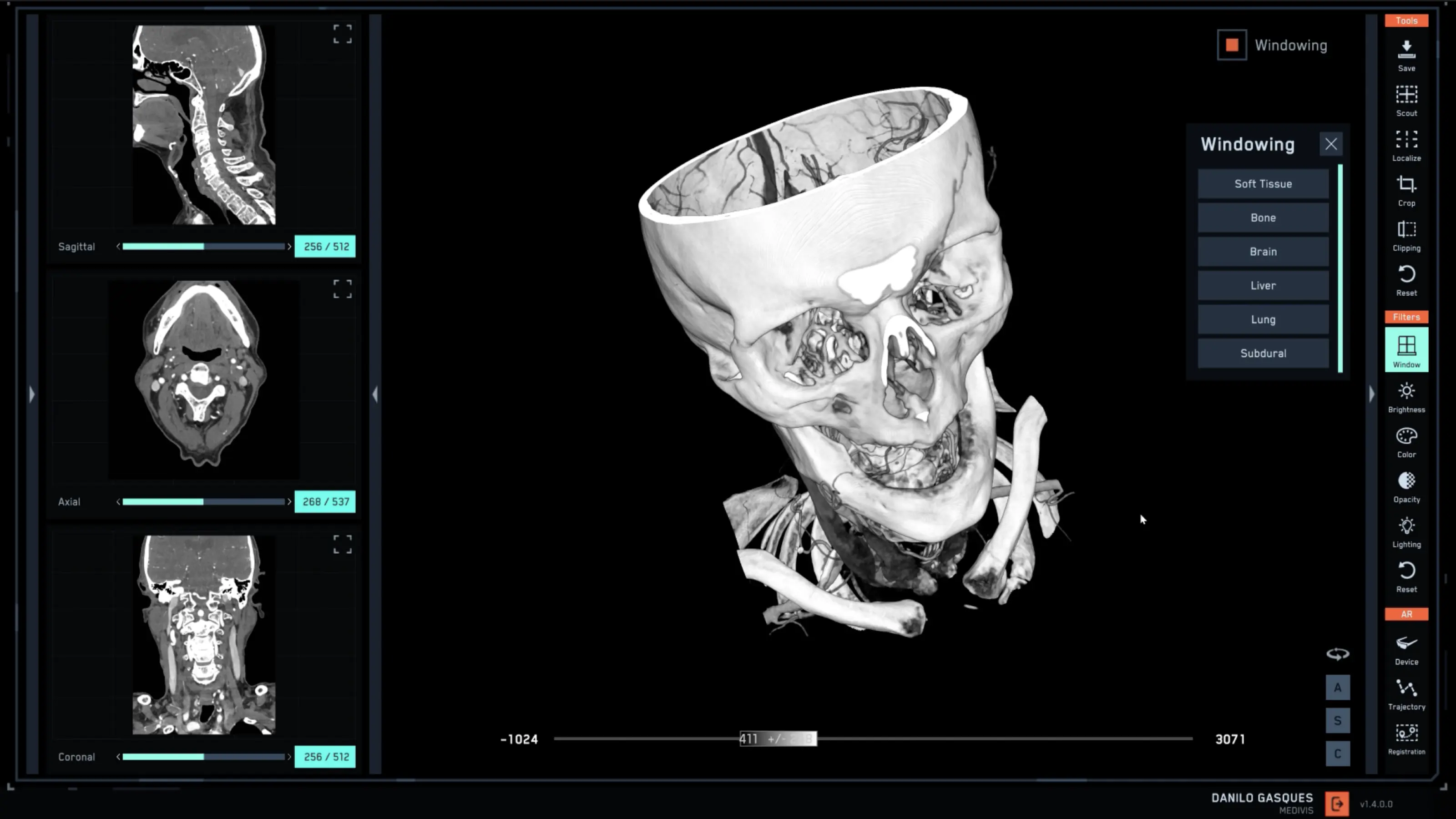 New Feature — Better visualization and differentiation of tissues