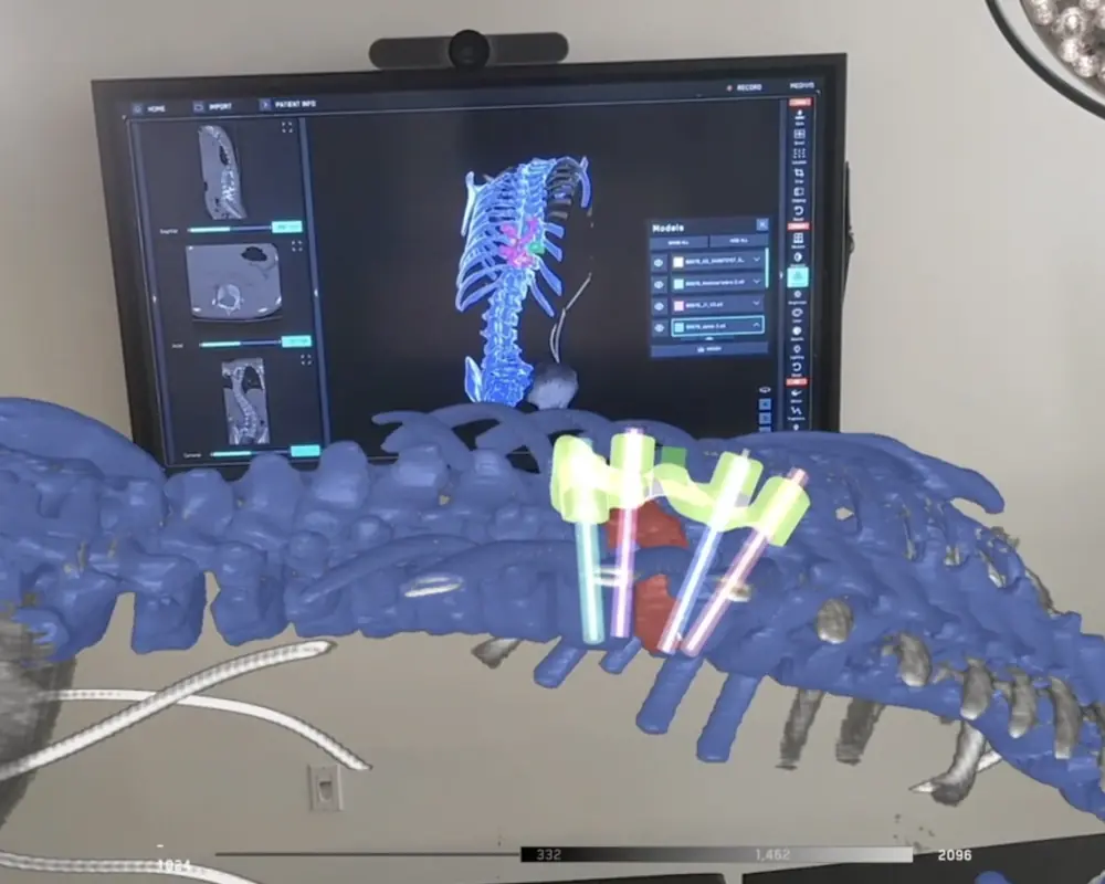 Product Updates | Medivis