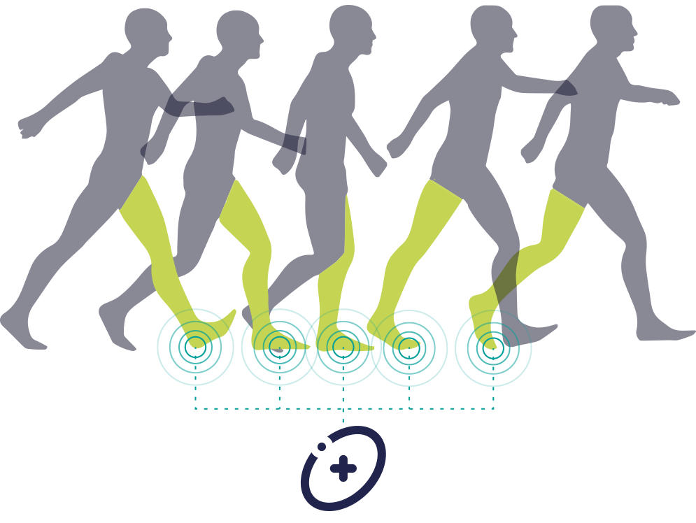 AI-based monitoring for improved Multiple Sclerosis management
