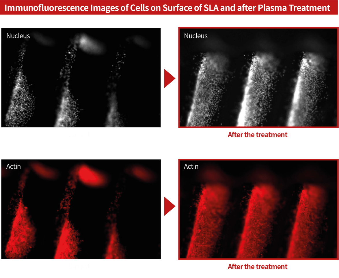 BIOGEN MEDI - ACTLINK Reborn